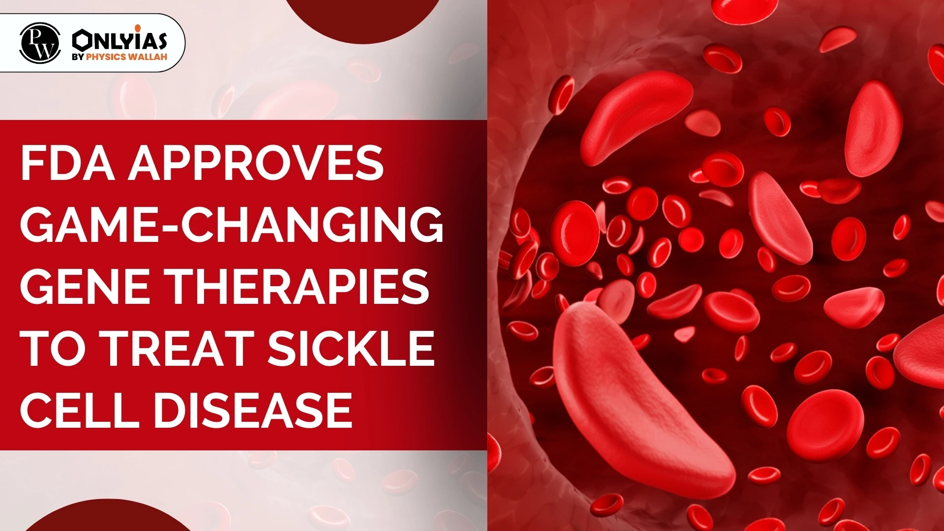 FDA Approves Game-Changing Gene Therapies To Treat Sickle Cell Disease ...