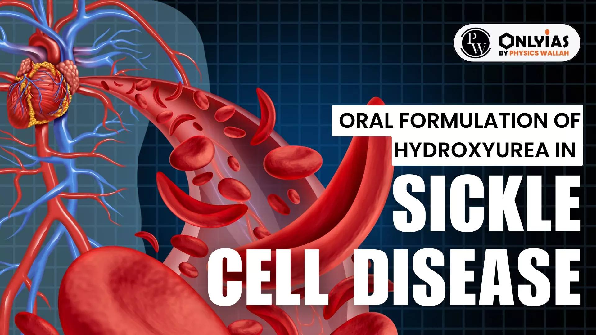 Oral Formulation Of Hydroxyurea In Sickle Cell Disease - PWOnlyIAS